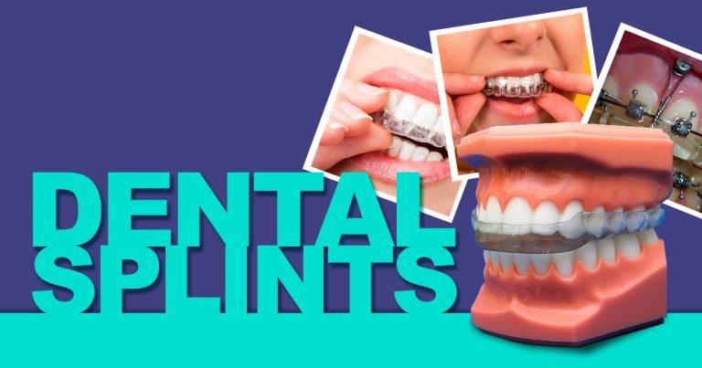 Types of Dental Splints for TMJ (Temporomandibular Joint Disorders)