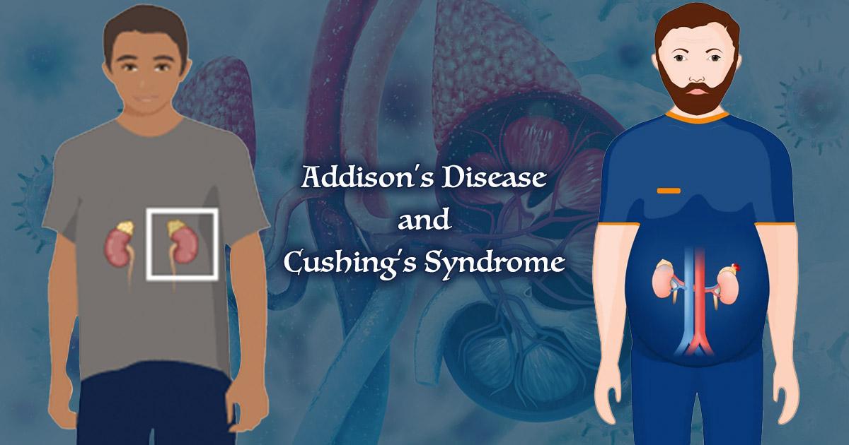 Addison's or Cushing's? Knowing the Symptoms to Tell Them Apart