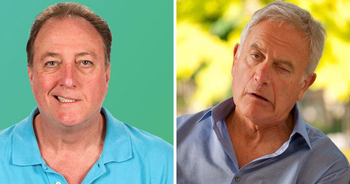 Differentiating Bells Palsy From Stroke A Guide