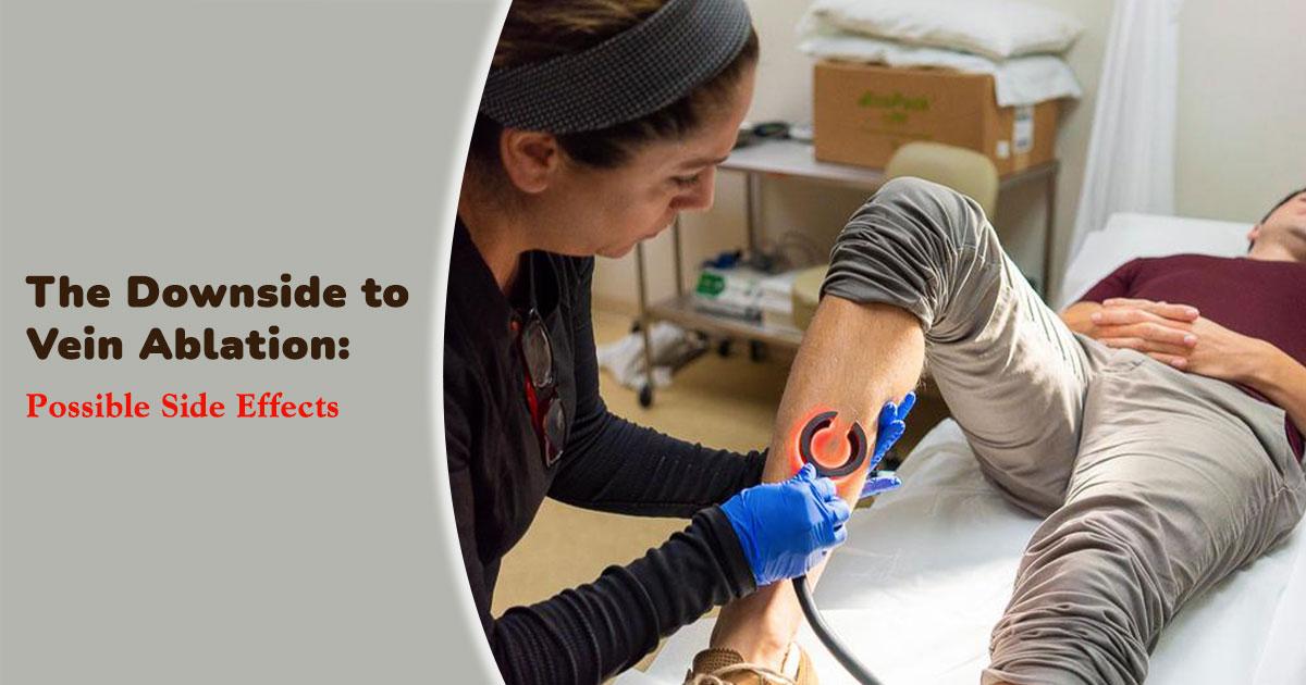 The Downside to Vein Ablation: Possible Side Effects