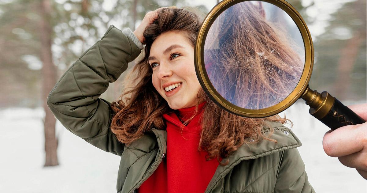 Why You Get Dandruff in Winter: Causes and Prevention Tips