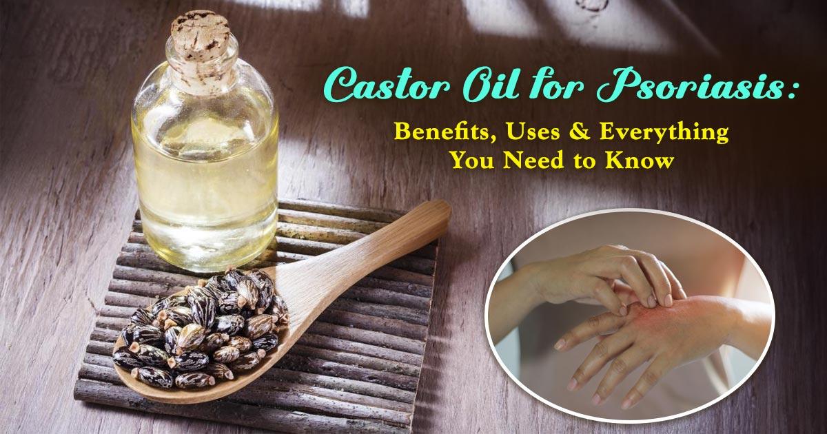 How to Use Castor Oil to Work Effectively on Scalp Psoriasis