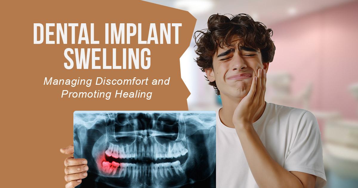 Dental Implant Swelling: What's Normal and When to Worry