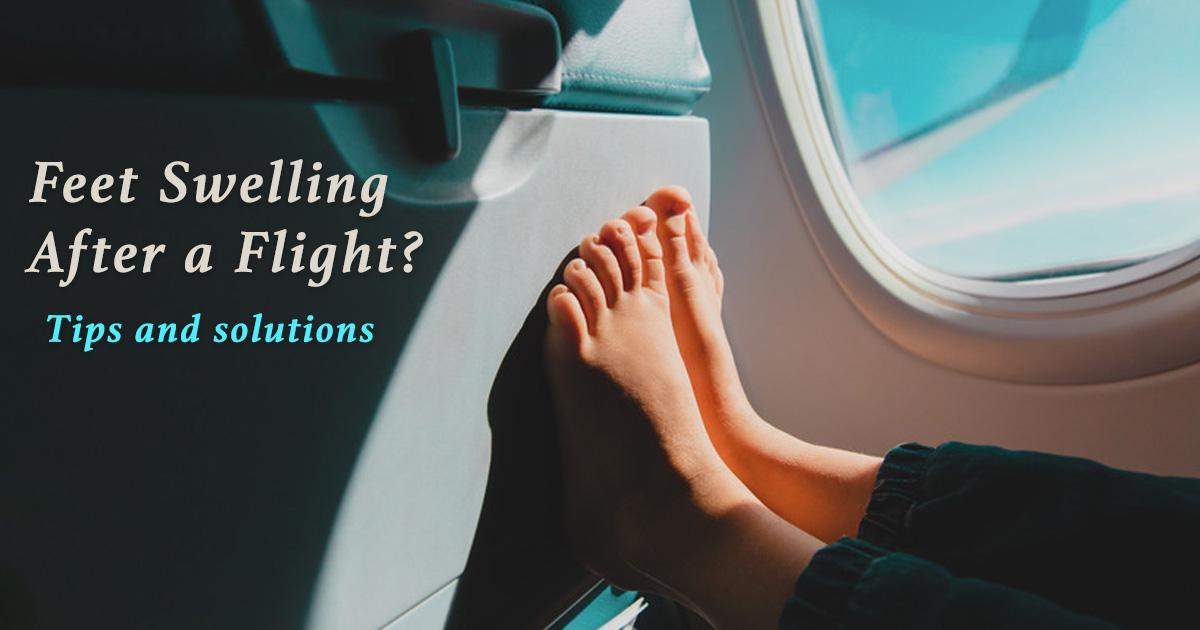 Puffy Feet After Flying? Quick Fixes