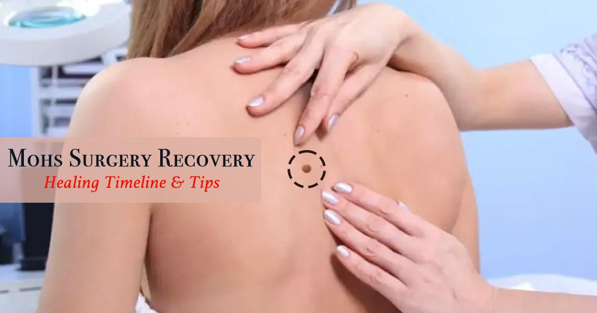 Mohs Surgery Recovery: Healing Timeline & Tips