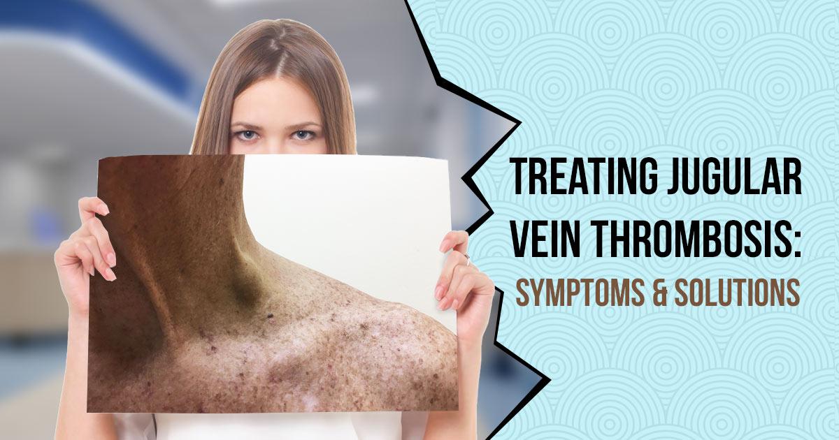 Jugular Vein Thrombosis: What to Expect from Treatment