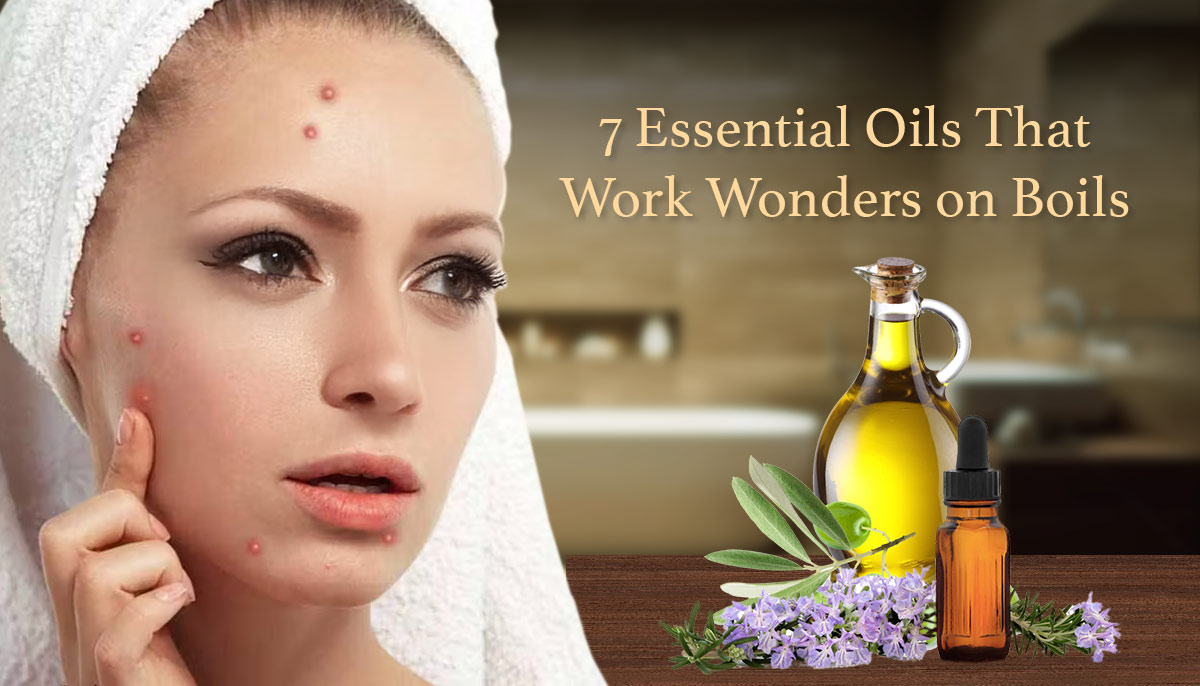 7 Effective Essential Oils for Boils