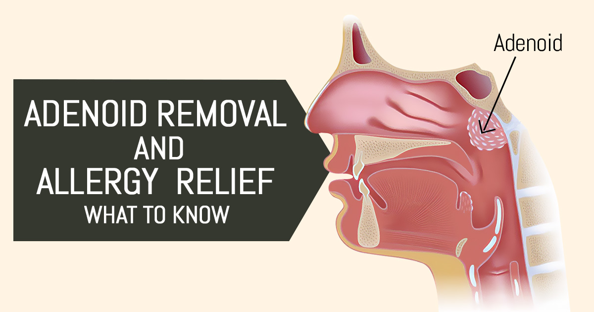 Adenoid Removal and Allergy Relief: What to Know
