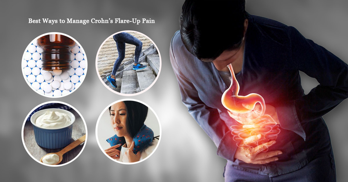 Pain Relief Solutions for Crohn's Disease Flare Ups