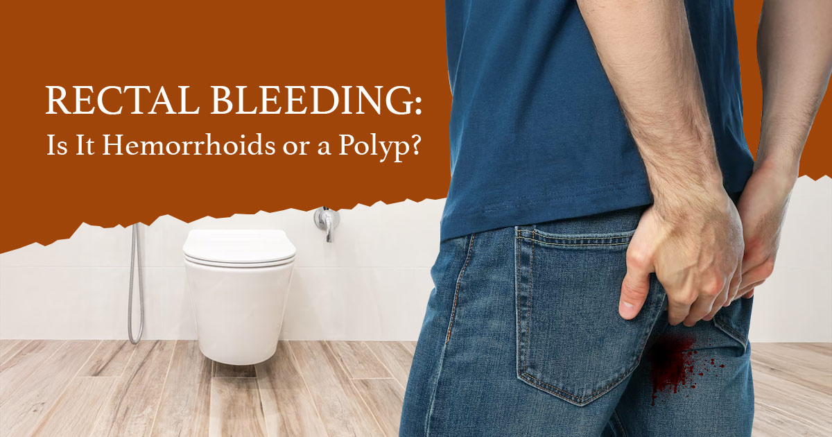 Hemorrhoids vs Polyps: How to Tell Them Apart