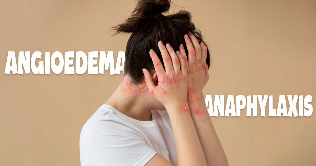 Angioedema vs. Anaphylaxis - Guide to Key Differences