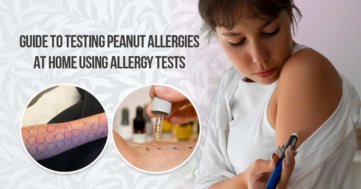 How to Test for Peanut Allergies at Home