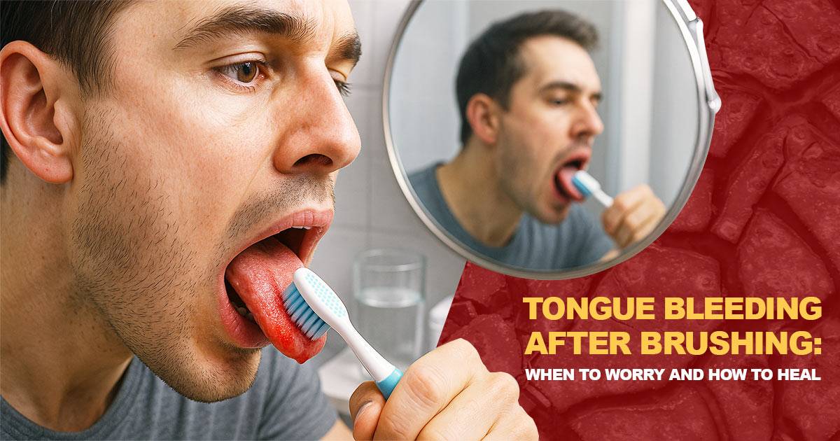 12 How to Stop Tongue Bleeding After Brushing Safely