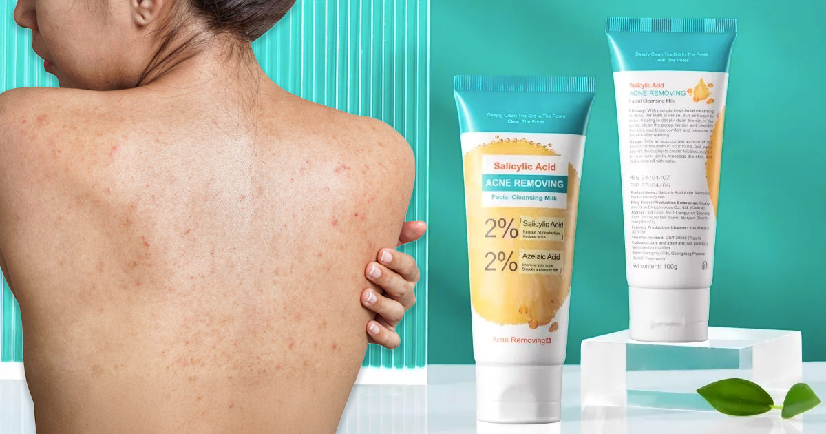 12 Proven Ways to Manage and Prevent Body Acne